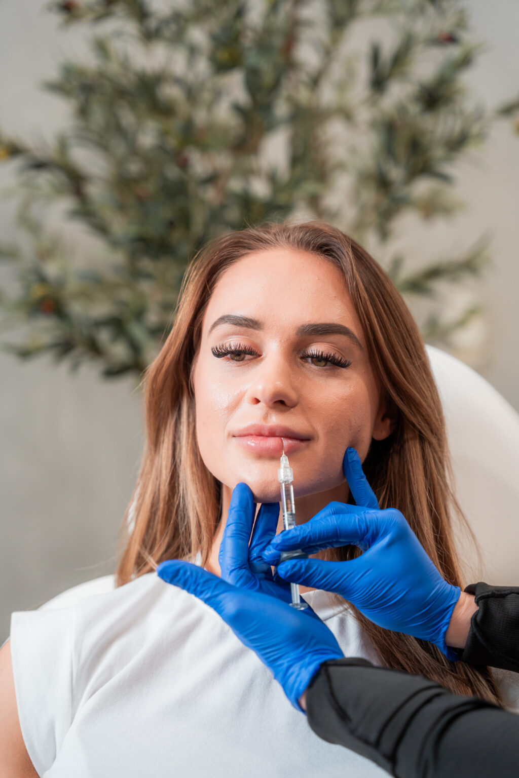 Dermal Filler in Charlotte NC - Relive Health